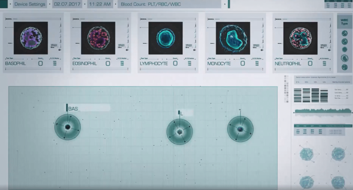 PixCell Medical – Portable Point of Care (poct) blood diagnostics