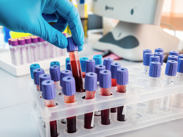 Clozapine and Monitoring the Absolute Neutrophil Count - PixCell Medical