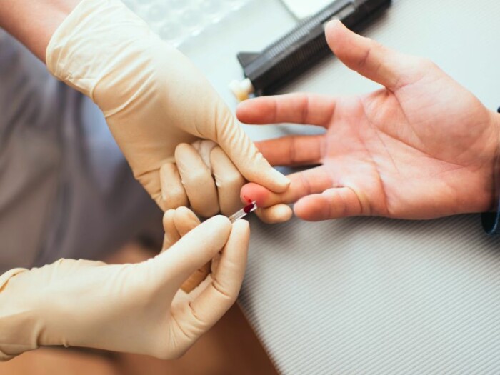 Clozapine and Monitoring the Absolute Neutrophil Count - PixCell Medical