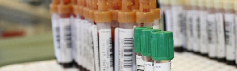 6 Ways Cancer Infusion Centers are Reducing Wait Times with Advanced ...